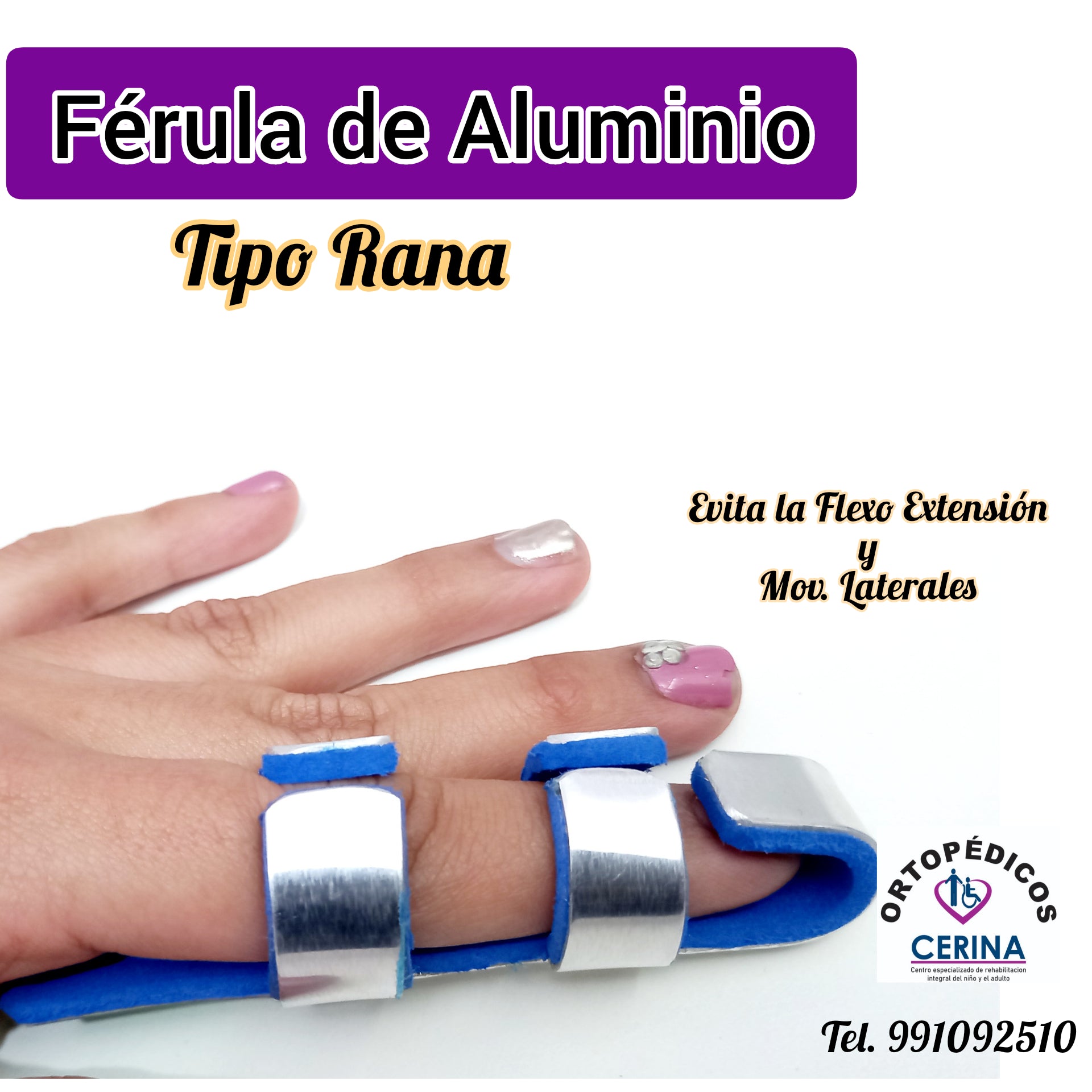 Férula para Dedo de Aluminio Tipo Rana – Cerina Ortopédicos